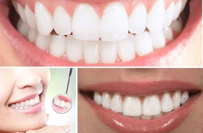 Dientes Incisivos: Función y Anatomía【2020】