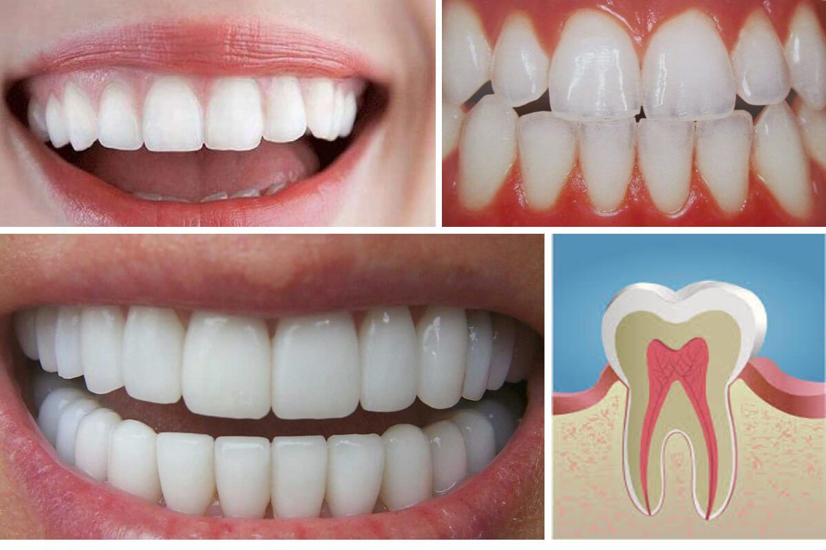 【Dientes 10】Toda la información dental | Tu Dentista Online