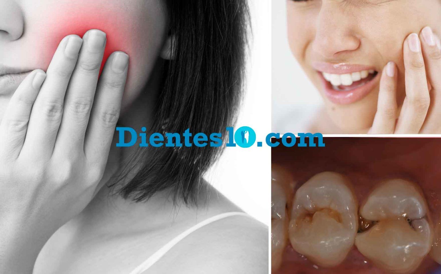 Pulpitis Dental: Tipos de Pulpitis y Tratamientos【2020】