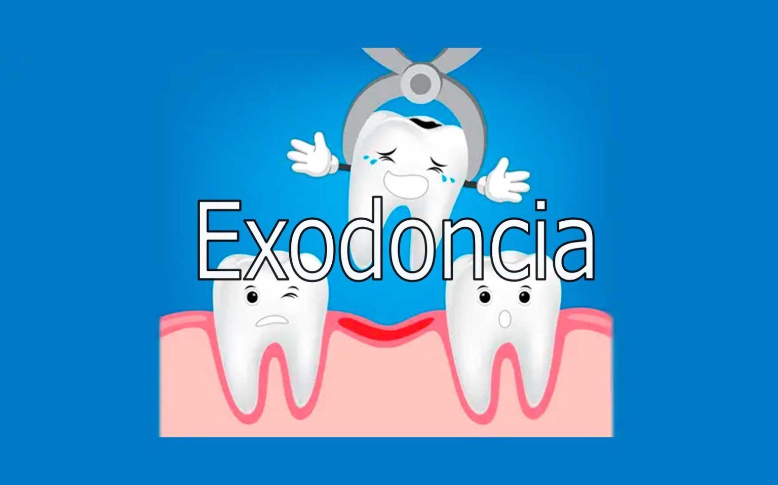 Exodoncia: Qué es y Tipos de Exodoncia en【2020】