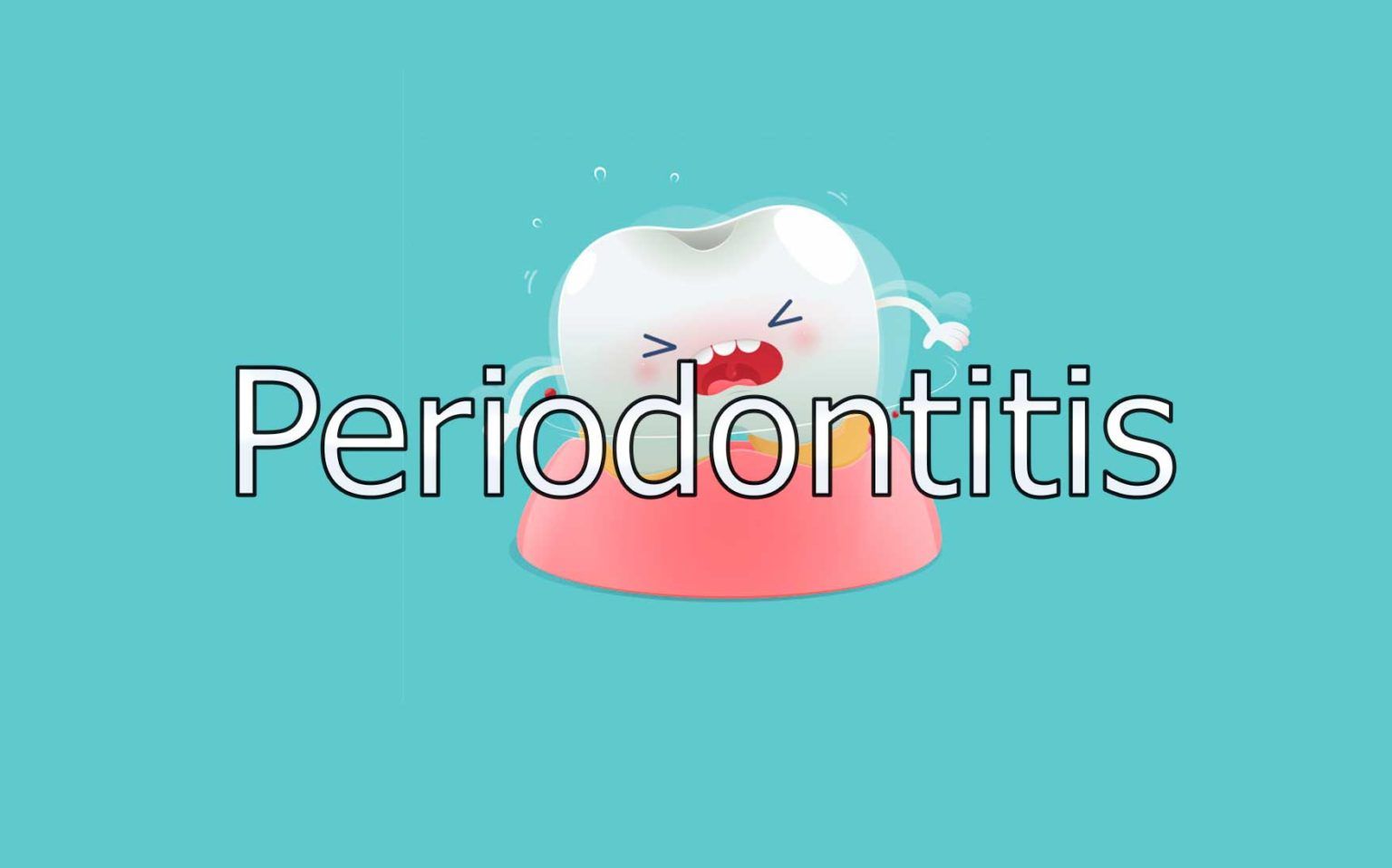 ¿Qué es la Periodontitis? Síntomas y Tratamientos en【2020】